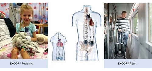 Berlin Heart Insights: Berlin Heart ist das einzige Unternehmen zur ...