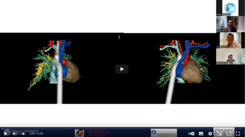 Berlin Heart industry lecture at ECHSA