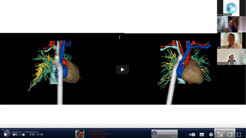 Berlin Heart industry lecture at ECHSA