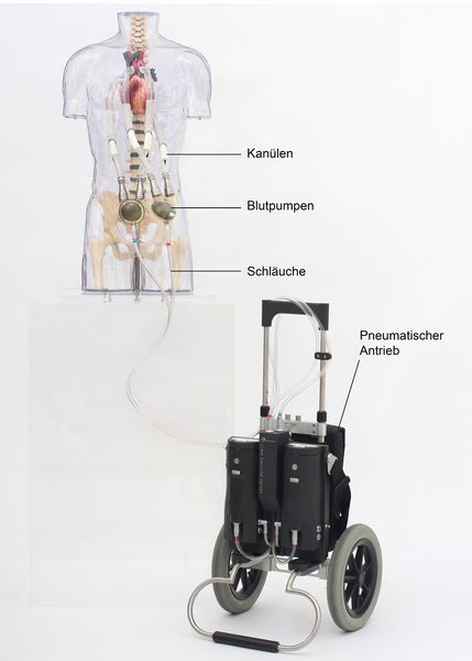 Patients and relatives EXCOR Adult